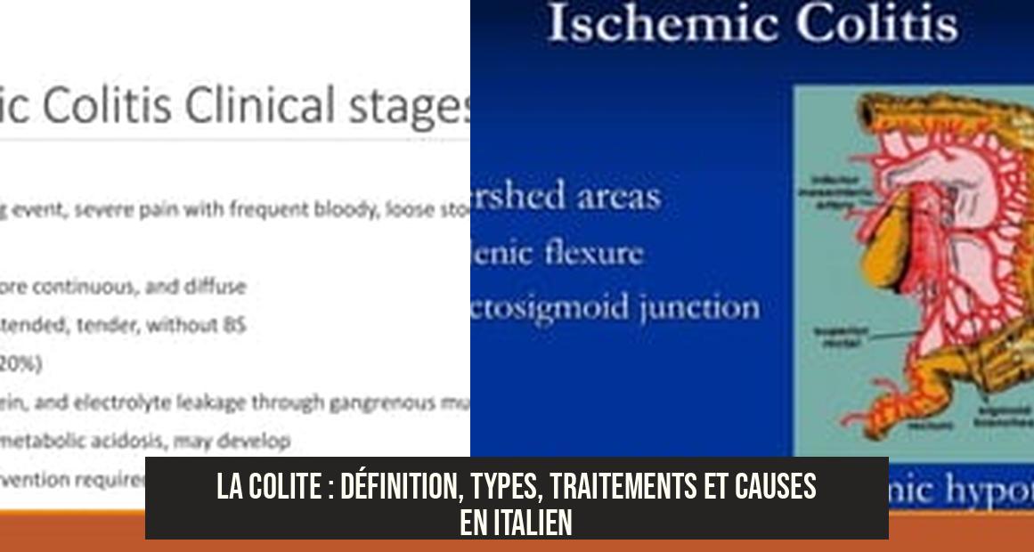 La colite : définition, types, traitements et causes en italien ...